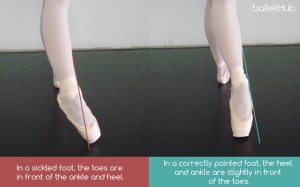 Sickling in Ballet: What, Why and How to Avoid It - BalletHub